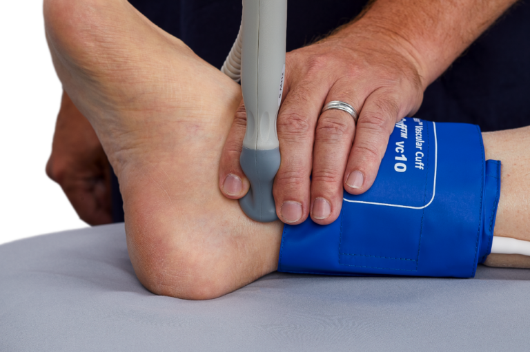 New SteadyDop Vascular Probe | Newman Medical