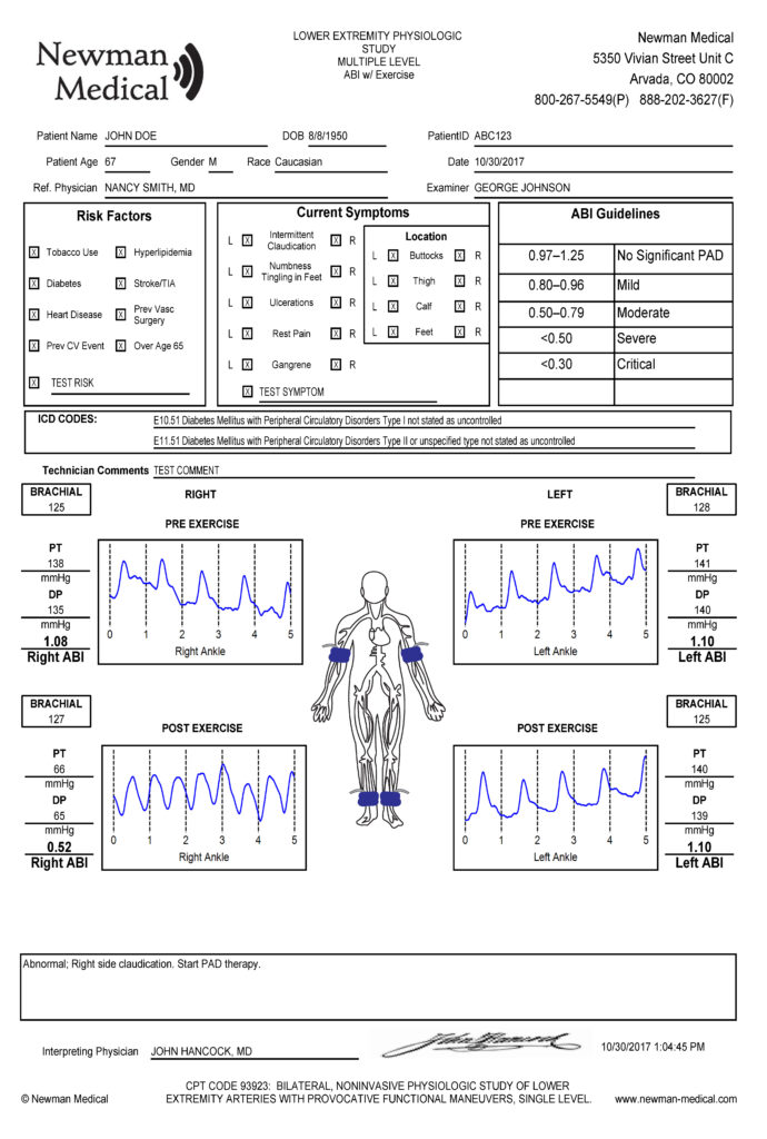 ABI with Exercise Exam | Newman Medical